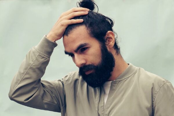 Useful Tips For Finding The Right Hair Transplant Services